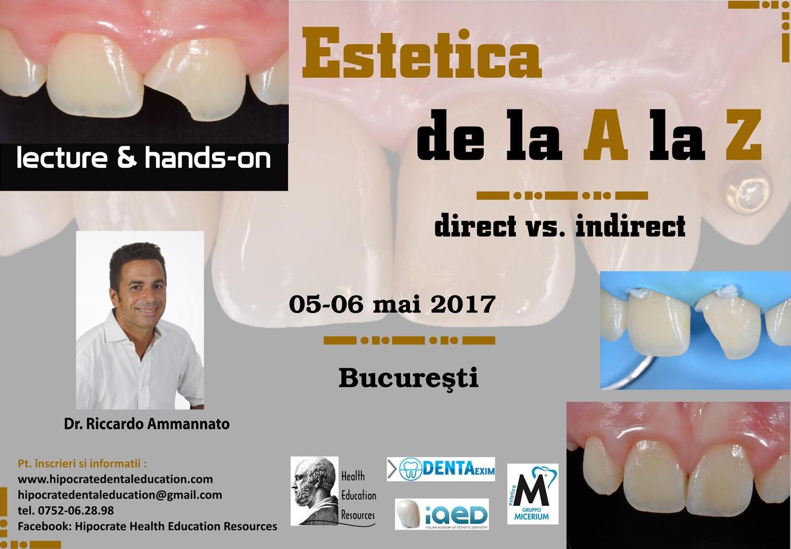 Estetichs from A to Z. Direct vs Indirect restorations on anteriors ...